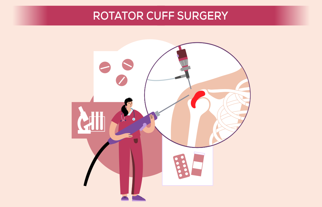 What is Rotator Cuff Surgery?