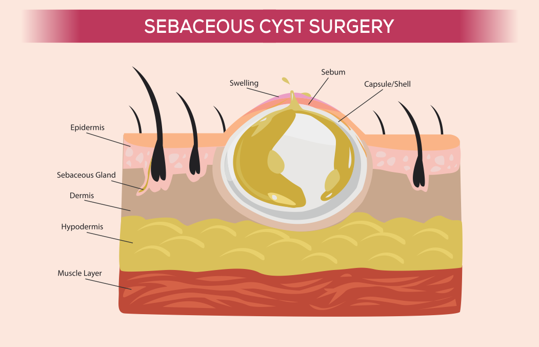 Preferred Location Select Location Banjara Hills Uppal Kachiguda